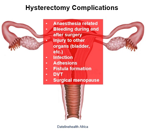 Understanding hysterectomt: why and how of womb removal surgery